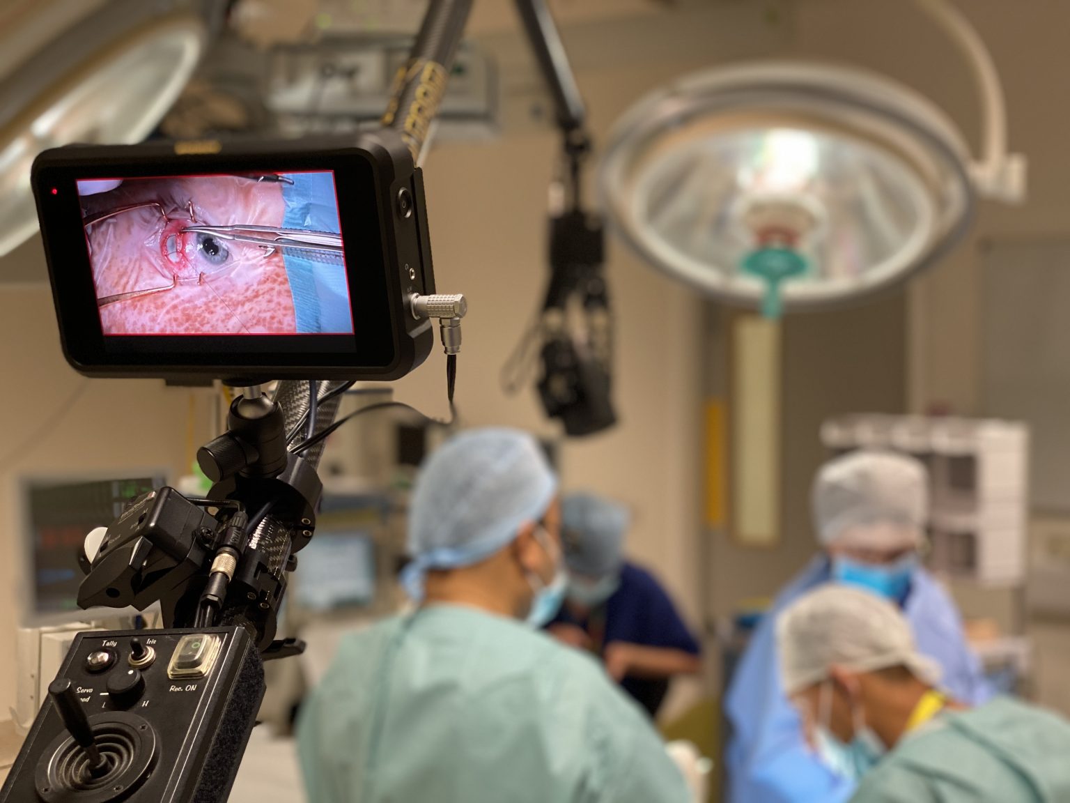 Cheshire Clear Vision – Bhamy H Shenoy| Paediatric ophthalmology ...